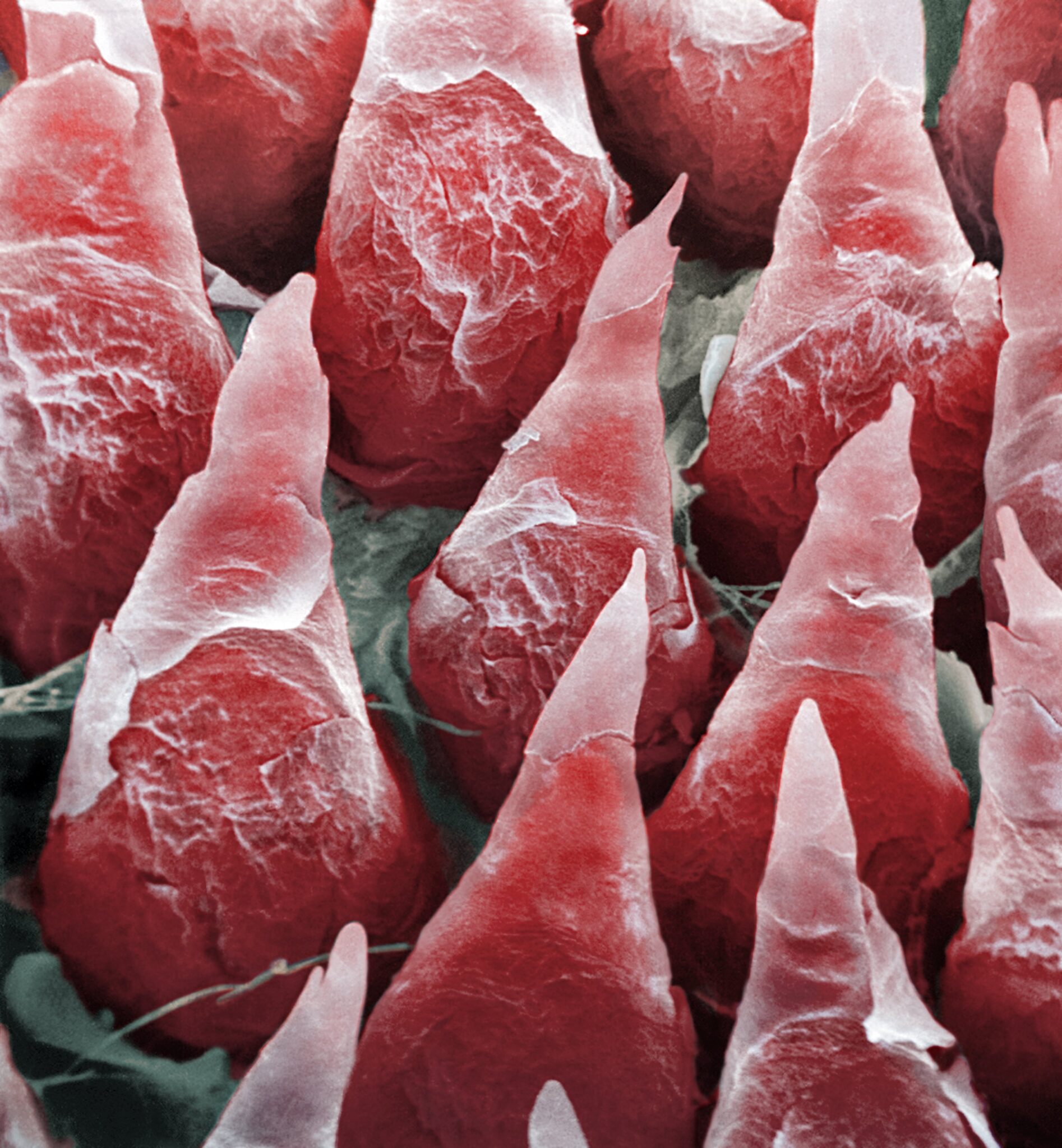 10 Oorzaken Witte Tong In 1 Overzicht (Mustread) - VraagDeTandarts.nl